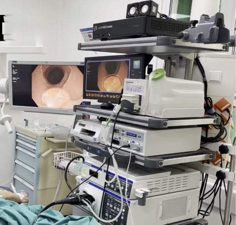 MedEndo (AI based GI Endoscopy Solution) - Megamind IT Solutions